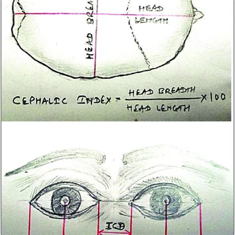 Schematic Diagrams Showing How To Measure Cephalic Index A And Download Scientific Diagram