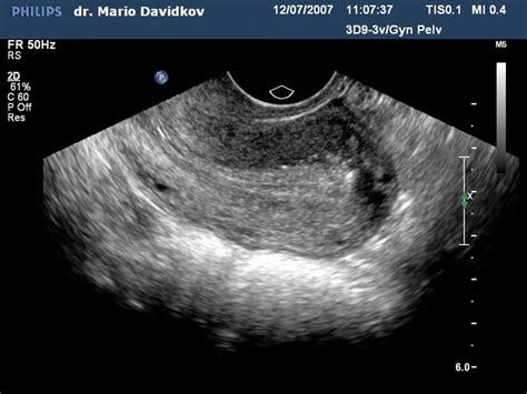 Значението на съвременната диагностика Медицински център Марио Давидков