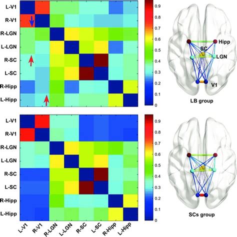 MNi Coordinates For Selected Seed Regions Download Table