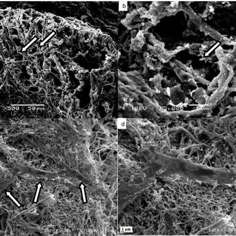 Scanning Electron Microscopy Of Decellularized And Recellularized Download Scientific Diagram
