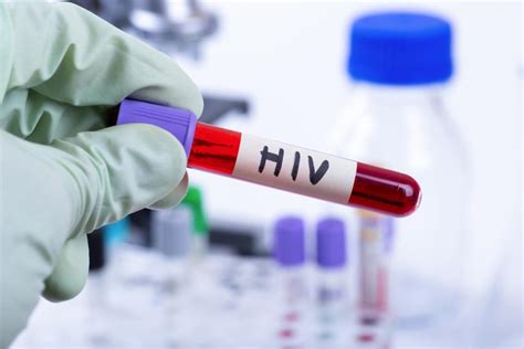 Fda Approves Trogarzo 90 Second Intravenous Iv Push Loading Dose For The Treatment Of Hiv