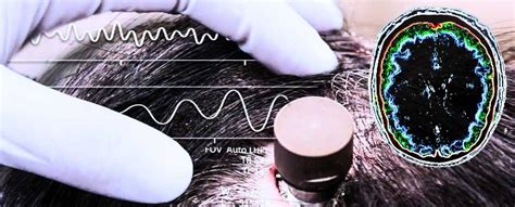 A Glimpse Into The Future Neural Interface Technology Revolutionizes