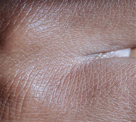 Take Christmas Tree Rash Seriously Doctors Explain How It Could Be