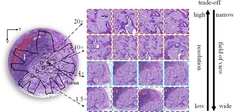 Inspiration Of Fovea Unet Left The Map Shows The Lnm Images From The Download Scientific
