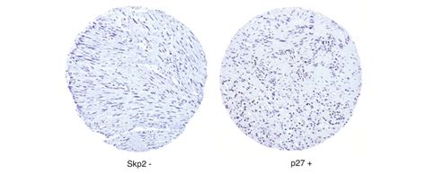 Cross Talk Between The Scf And Apc C Regulates Cell Cycle Progression