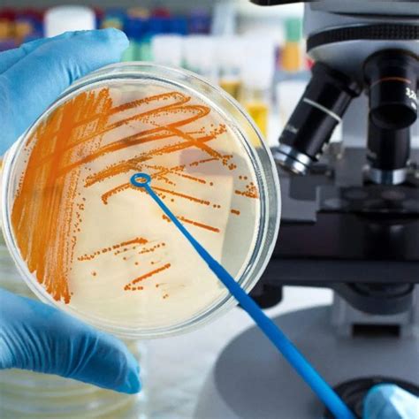 Microbiology Testing Labs At ₹ 1500 Sample In Chennai Id 2855291780930