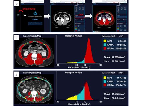Muscle Quality Map Generation Using An Automated Web Based Toolkit Download Scientific Diagram