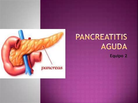 Ppt Pancreatitis Aguda Powerpoint Presentation Free Download Id