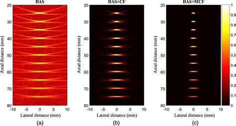 Enhanced Linear Array Photoacoustic Beamforming Using Modified Coherence Factor