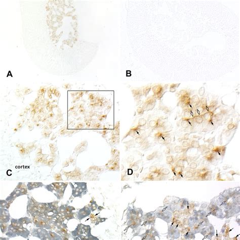 Pdf Pendrin Localizes To The Adrenal Medulla And Modulates Catecholamine Release