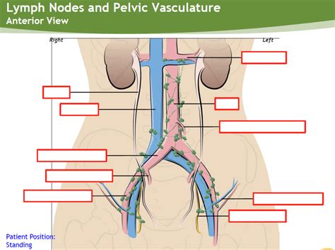 Internal Iliac Lymph Nodes