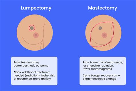 Lumpectomy Vs Mastectomy Whats The Difference