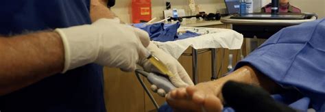 Non Surgical Ankle Tendon Tear Treatment In Laguna Hills Ca