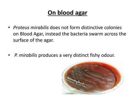 Proteus Spp Lecture Pptx