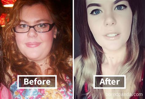 128 Surprising Photos Of Face Fat Loss Before And After Weight Loss