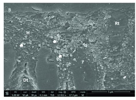 A Field Emission Scanning Electron Microscopic Fe Sem Micrograph Of