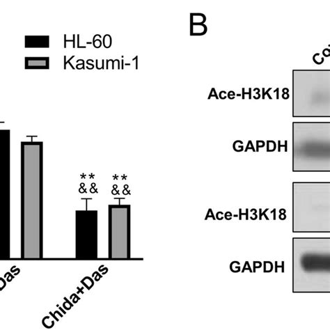 Chidamide Synergized With Dasatinib In Inhibiting The Proliferation Of Download Scientific