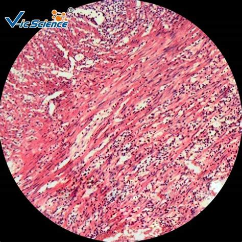 Microscope Slide Of Pathology Disease Educational Slides