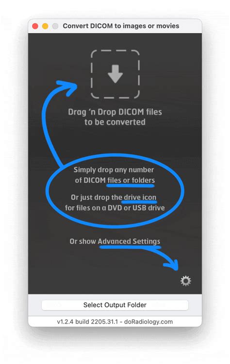 Dicom Converter Drag N Drop Batch Conversion Of Dicom Data To Images