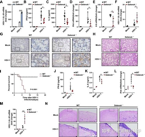 Plos Pathog︱山东大学贾木天 赵伟团队揭示硒蛋白调控sting激活新机制 知乎