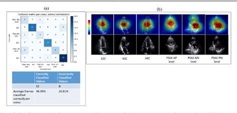 Figure 5 From Classification Of Echocardiogram View Using A Convolutional Neural Network