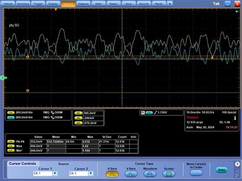 DP E DP E Xilinx Zynq Mpsoc SGMII Mode With TI DP PHY Link Issue Interface