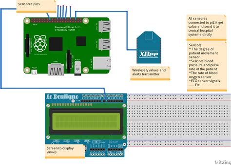 The Smart Hospital Bed Hackster Io