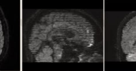 Dti Quality Control Part 3 Tools Diffusion Imaging Introduction Tutorials And Background
