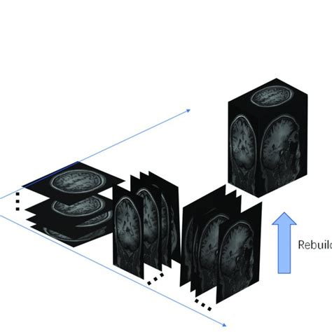 Comparison Of Srcnn [36] Fsrcnn [27] Edsr [15] Srgan [17] Esrgan Download Scientific