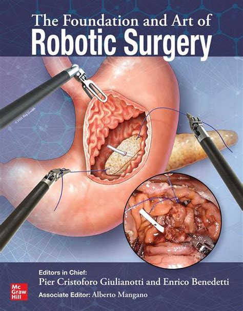 Liver Sectionectomies Left Lateral Sectionectomy The Foundation And Art Of Robotic Surgery