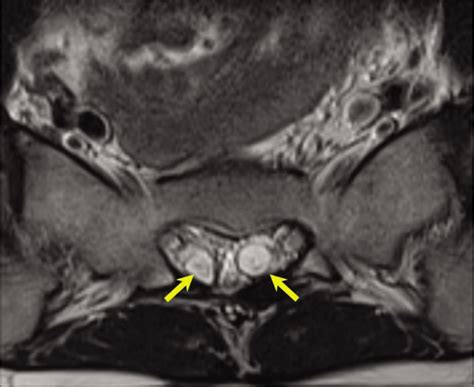 Surgical Neurology International