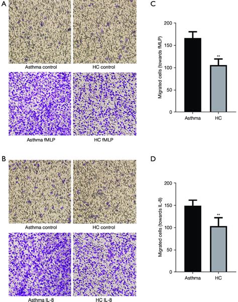 Aberrant Neutrophil Migration And Chemotaxis In A Patient With
