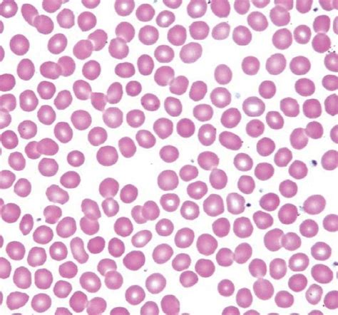 Eritrocitos Célula con forma de disco bicóncavo