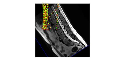 matlab how to perform hough transform on canny edge image stack
