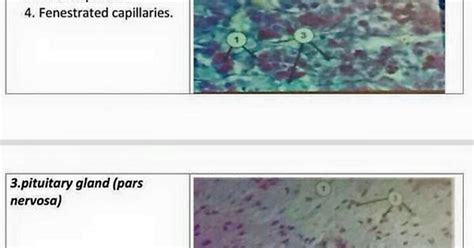 Endocrine System Album On Imgur