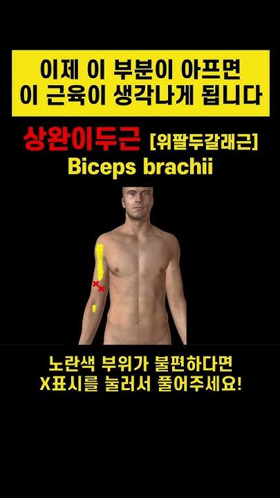 어깨앞쪽통증 팔꿈치앞쪽통증 상완이두근 알통 통증유발점 Youtube