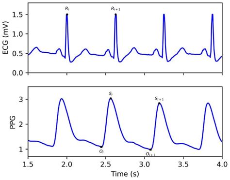 Ppg2ecgps An End To End Subject Specific Deep Neural Network Model For Electrocardiogram