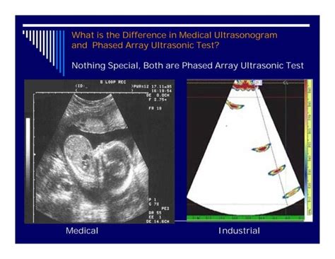 Presentation On Prospect Of Non Destructive Testing And Condition