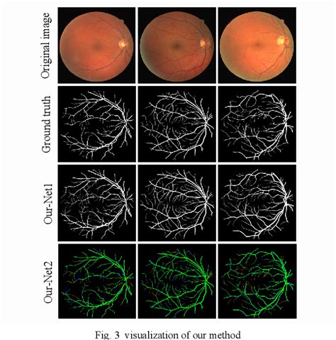 Figure 1 From A Novel Dual Supervised Convolutional Network For Retinal Vessel Segmentation