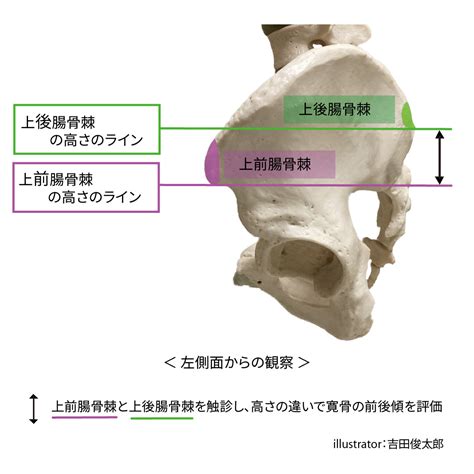 解剖骨盤アライメント触診精度を高めるための情報 触診解剖ブログ
