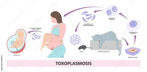 Toxoplasmosis Cyst Fecal Life Cycle Cat Retina Eye Hiv Aids Mother