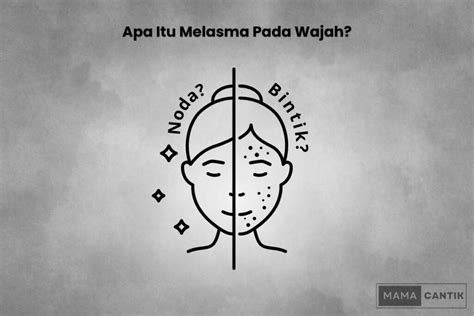 Apa Itu Melasma Gejala Ciri Penyebab Dan Cara Mengatasi