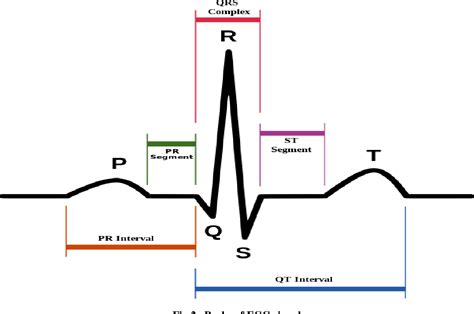 Figure 3 From A Review On Arrhythmia Detection Using Ecg Signal Semantic Scholar