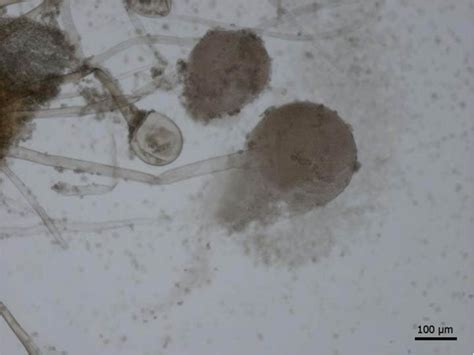 Rhizopus Stolonifer Qué Es Características Morfología Ciclo Vital