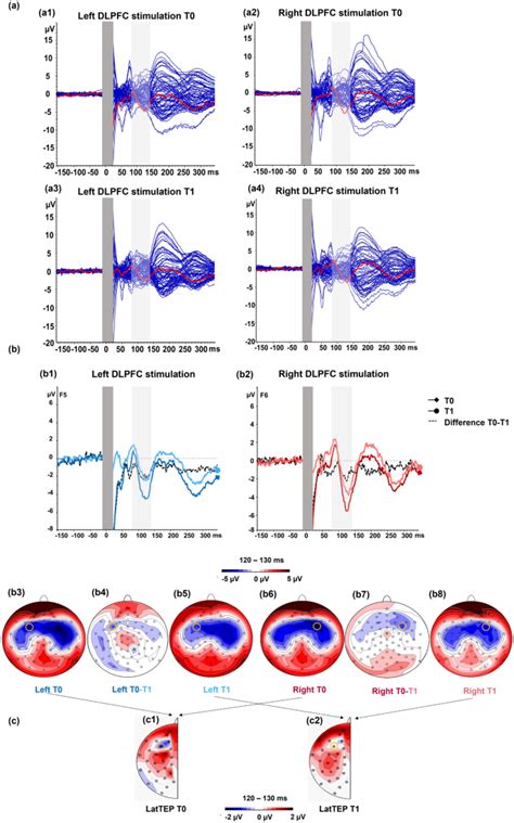 青少年抑郁严重程度与背外侧前额叶皮层 Tms 诱发电位 N100 的变化 Journal Of Neural Transmission X Mol