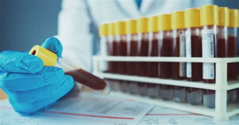 High Triglycerides Risks Causes And Treatments