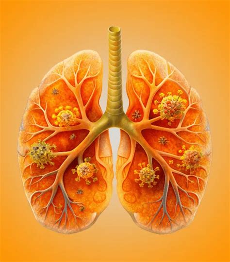 Best Surgical Oncologist In Gurgaon Dr Vidur Garg