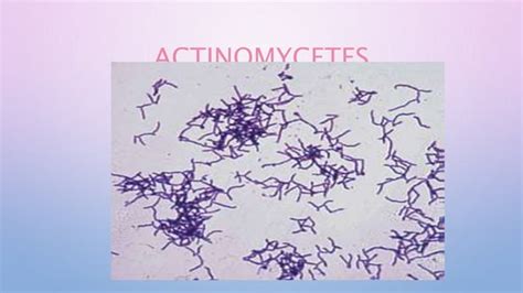 Nocardia Actinomyces And Streptomyces Latest1 Pptx