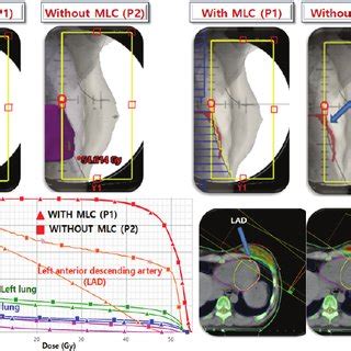 RTOG And Restrictive Dose Constraints Download Table