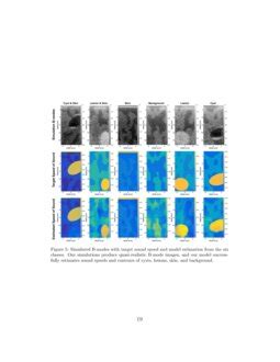 Investigating Pulse Echo Sound Speed Estimation In Breast Ultrasound With Deep Learning DeepAI